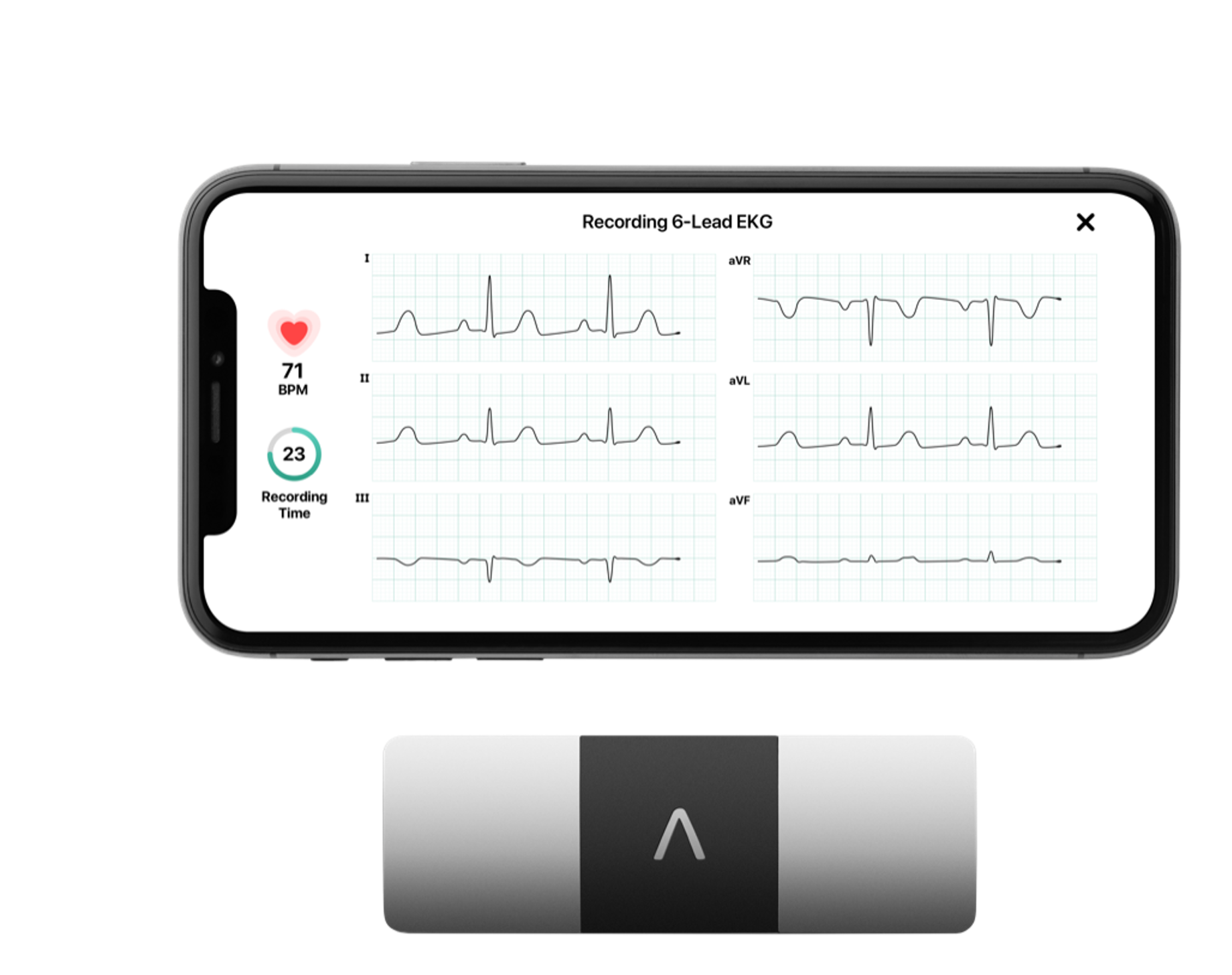 Portable ECG device keeps patients at the heart of mental health care ...